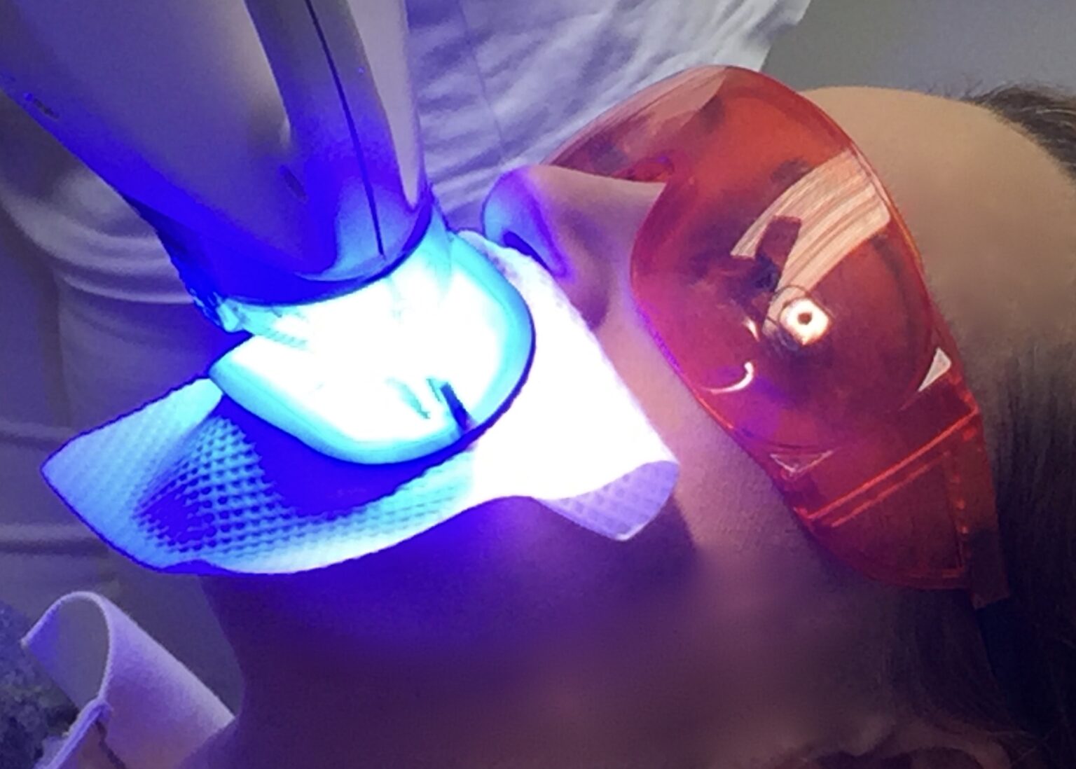 Dr. Piehslinger Zahnarzt | sanftes effizientes Bleaching mit LED